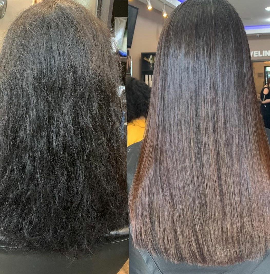 Before And After Page – ProAddiction USA