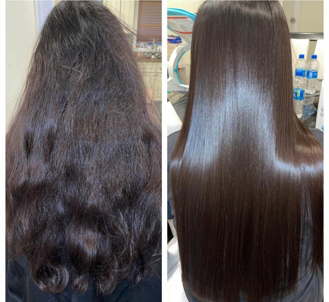 Before And After Page – ProAddiction USA