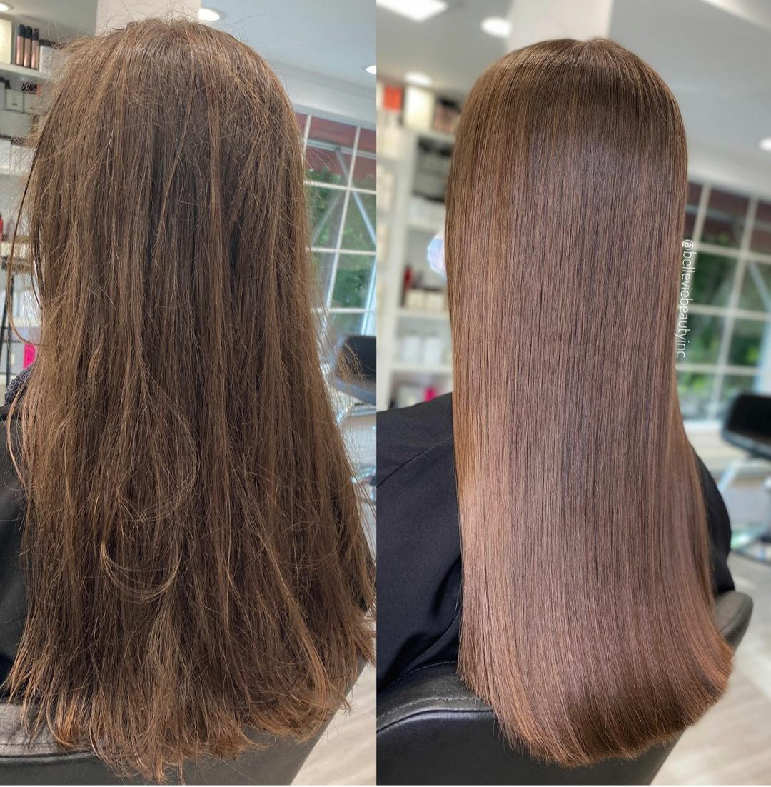 Before And After Page – ProAddiction USA